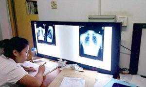 X-ray Film Viewer - Medicare Singapore