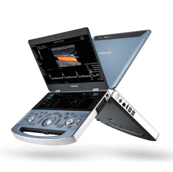 Mindray Diagnostic Ultrasound System - Medicare